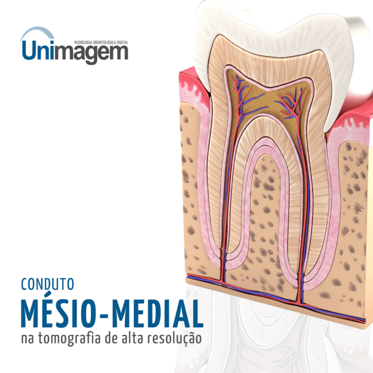 Conduto Mésio-medial - UNIMAGEM