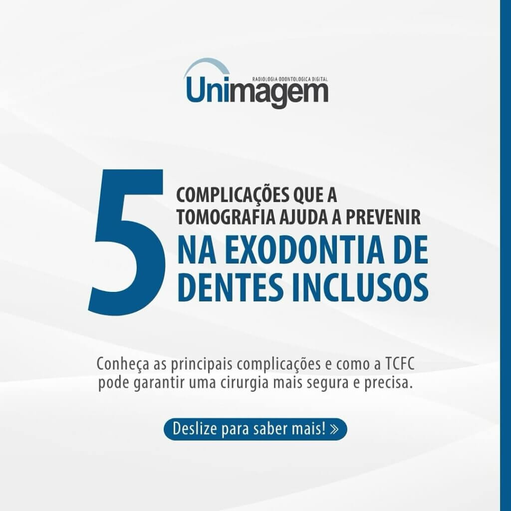 Exodontia de Dentes Inclusos - UNIMAGEM